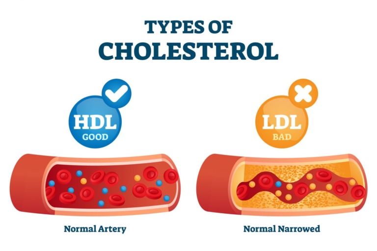 About Cholesterol - Morelia Medical Clinic